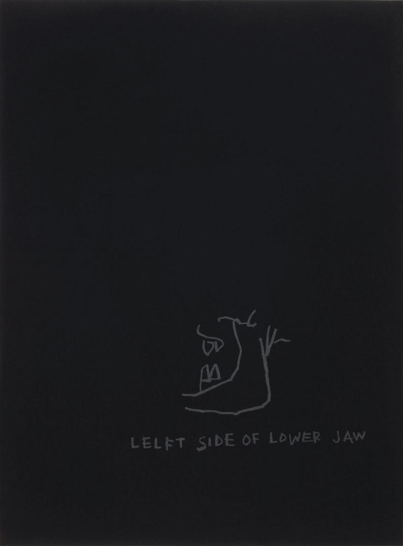 Jean-Michel Basquiat Anatomy, Left Side Of Jaw (Signed Print) 1982 ...