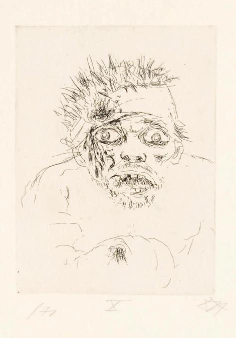 Otto Dix Wounded Man Fleeing (Signed Print) 1924 | MyArtBroker
