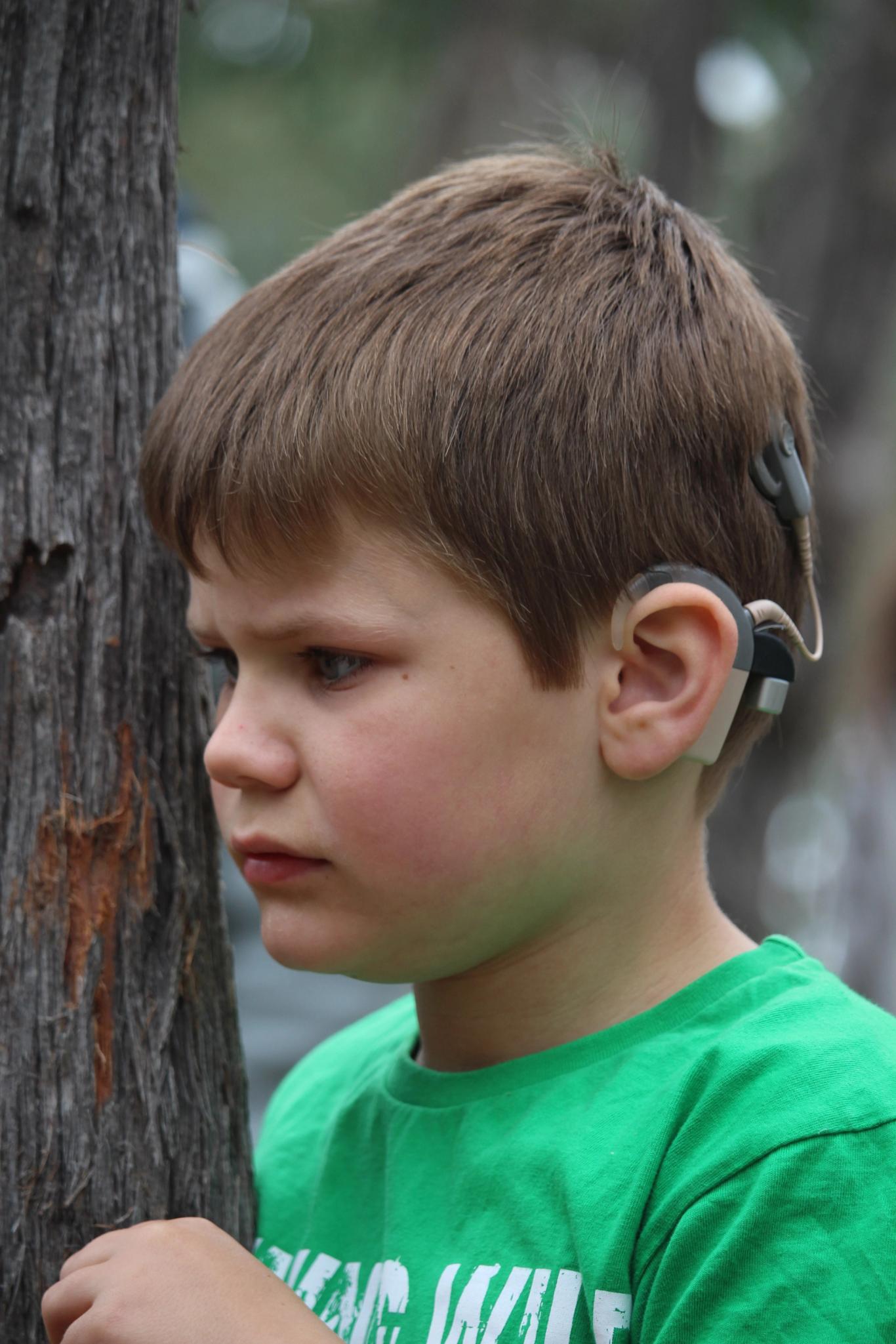 All about cochlear implants | Flying Colours