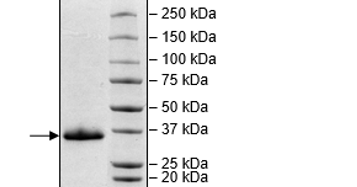 Spike S1 RBD, Avi-His-tag (SARS-CoV-2) Recombinant | XL Biotec