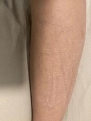 Scaly Skin Patches On Legs Scaly Skin Patches On Legs