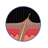 Strawberry Skin—Causes, Treatment, & Prevention | Soft Services | the ...