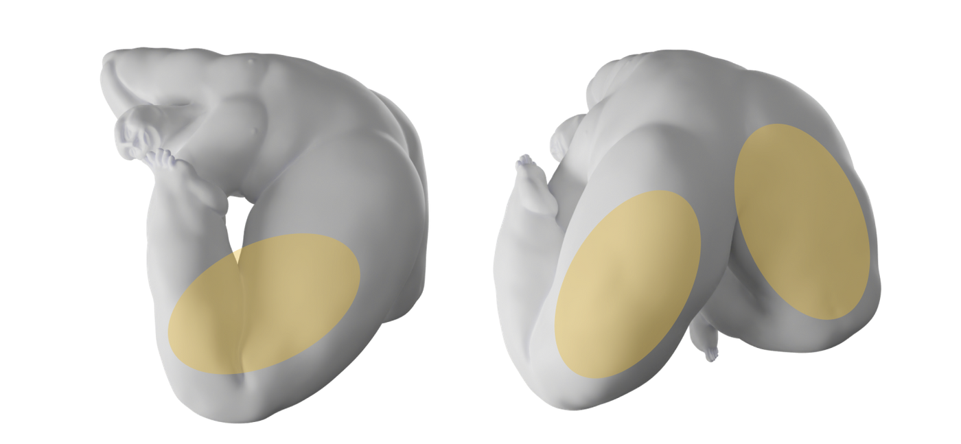 Strawberry Skin—Causes, Treatment, & Prevention | Soft Services | the ...