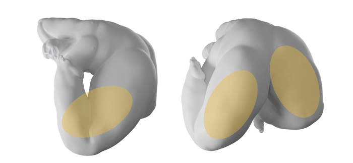Strawberry Skin—Causes, Treatment, & Prevention | Soft Services | the ...