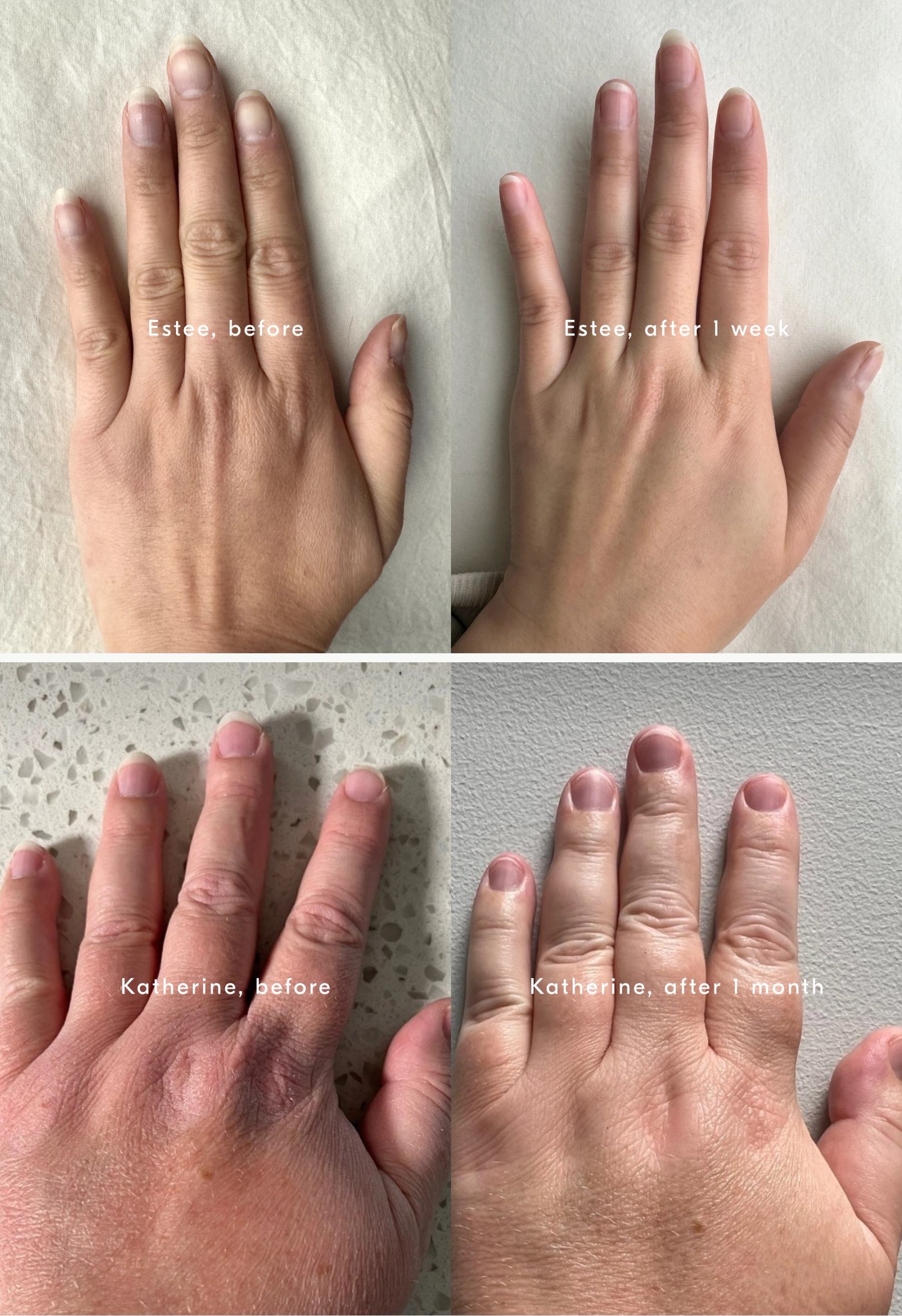 Theraplush, Overnight Repair Treatment for Hands | Soft Services | the ...