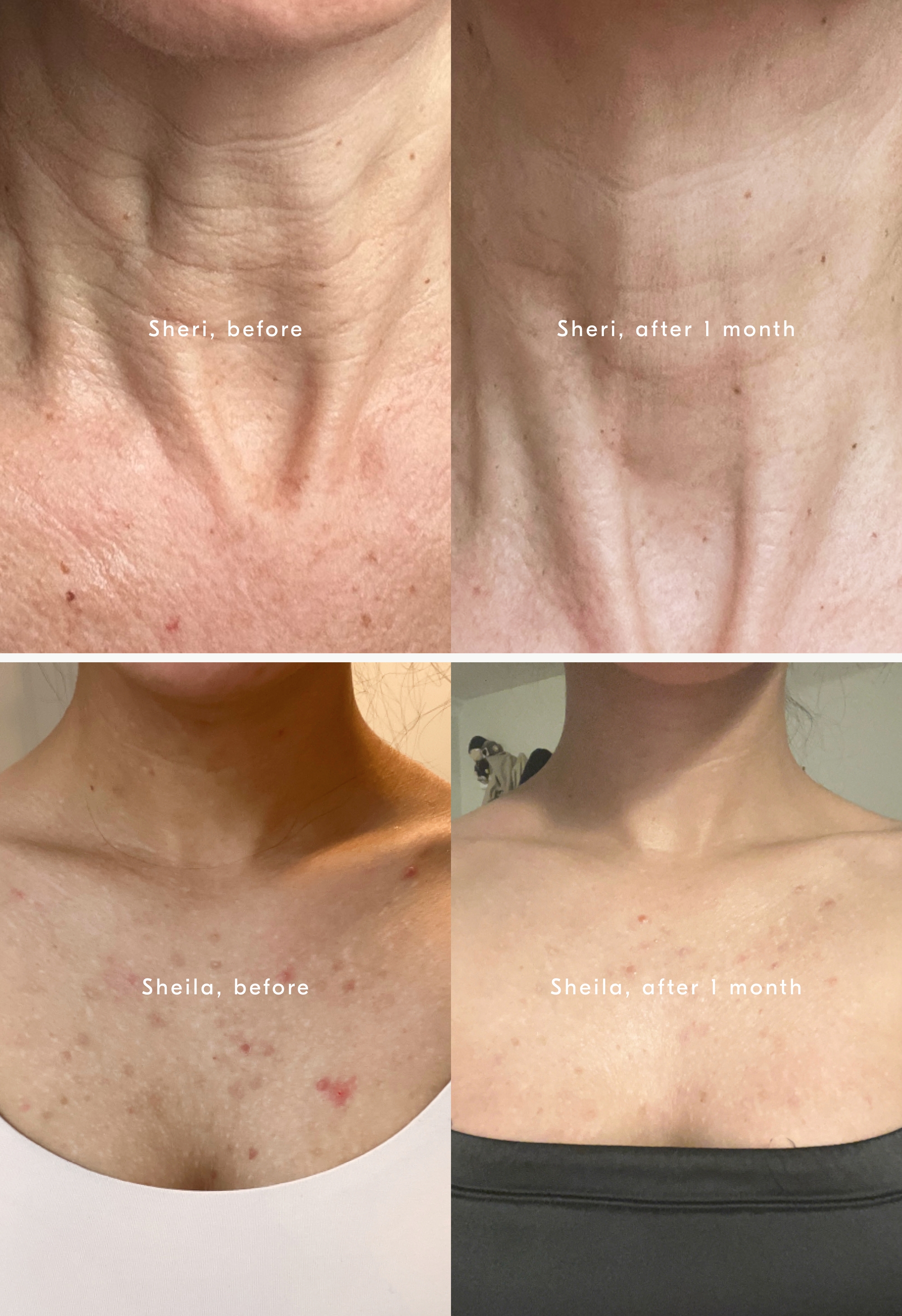 Software Update, Performance Retinol Serum | Soft Services | the body ...