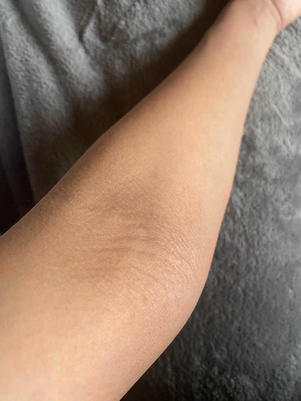 Dry Skin Image Gallery—Pictures on Hands, Legs | Soft Services | the ...