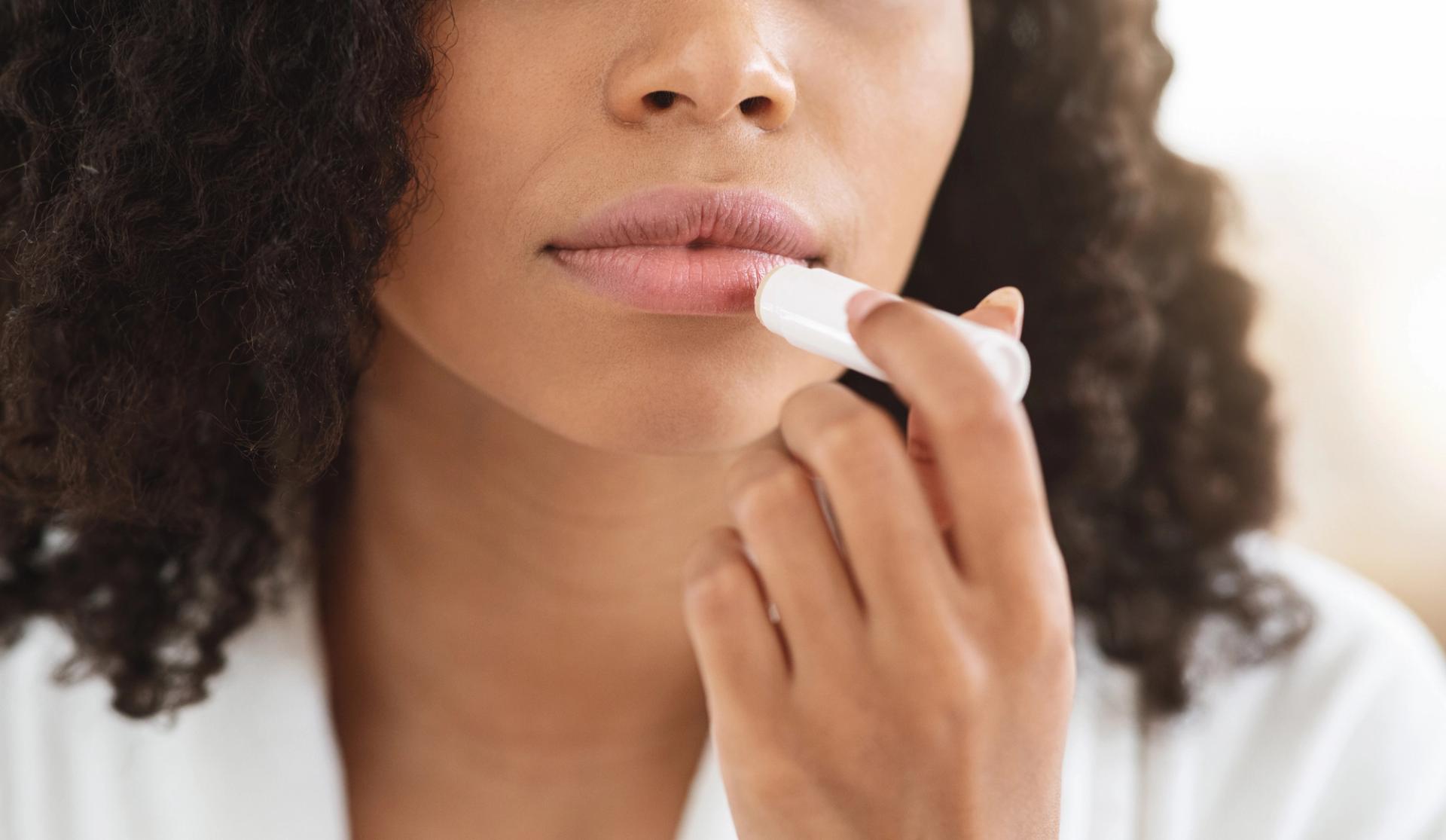 How to Prevent Chapped Lips in the Winter