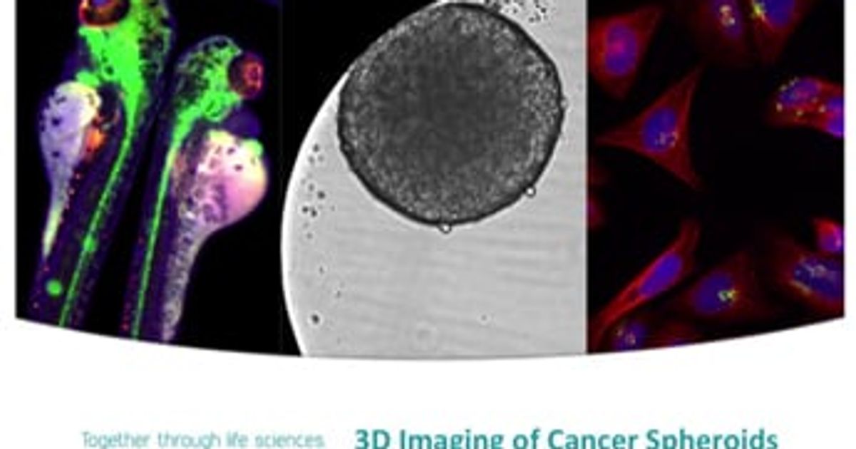 3D Imaging of Cancer Spheroids with the ImageXpress Micro XLS System ...