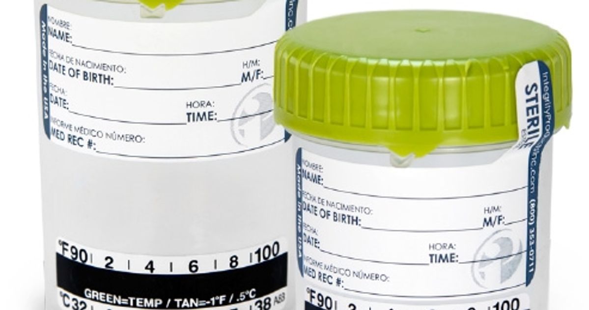 Specimen Cups reviews