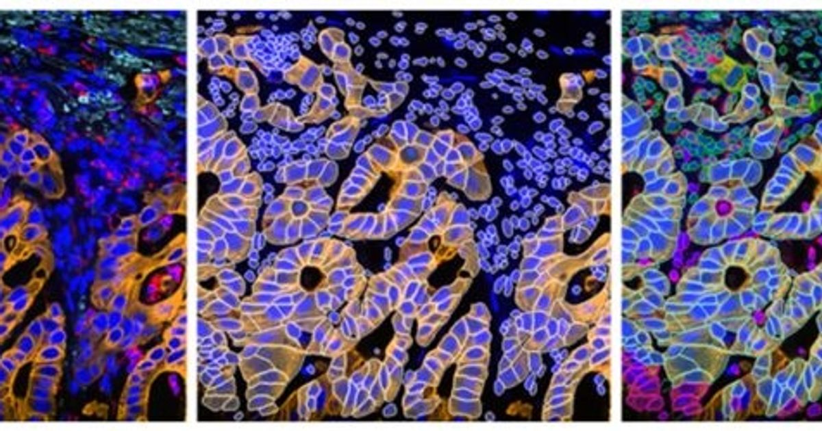 Researchers gain deeper spatial insights with multiplexed 2D image analysis tool