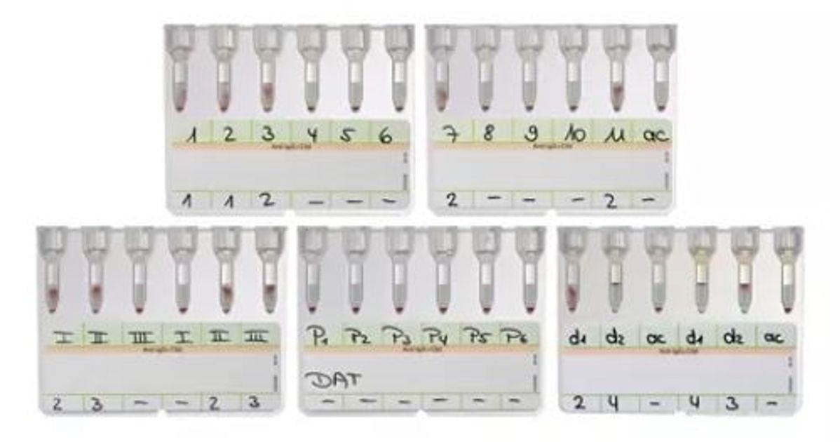 Buy LISS/Coombs ID-Card Read Reviews
