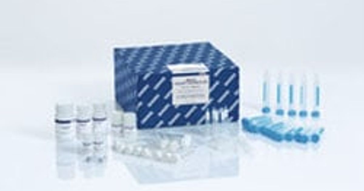 RNeasy PowerSoil Total RNA Kit reviews