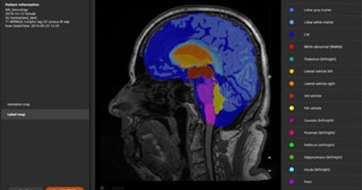 AI-based assistants for magnetic resonance imaging