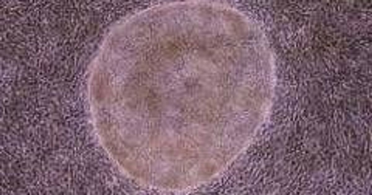 Millipore’s MEL Cell Lines Advance Human Embryonic Stem Cell Research