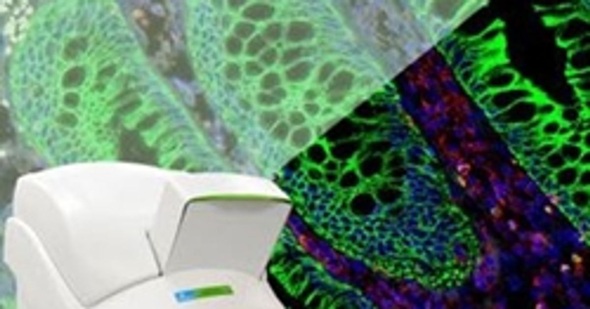 PerkinElmer Launches Innovative High Throughput Imaging System for ...