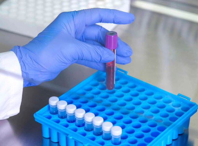 What the FDA’s final rule on LDTs means for clinical laboratories