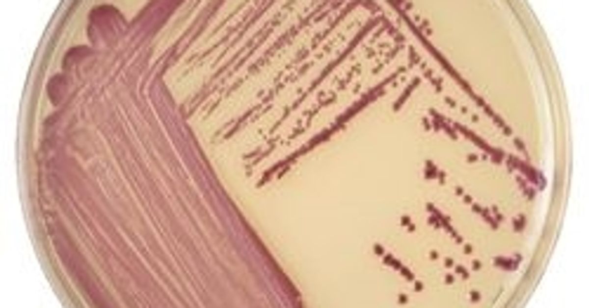 BD BBL™ CHROMagar™ MRSA II Plate reviews