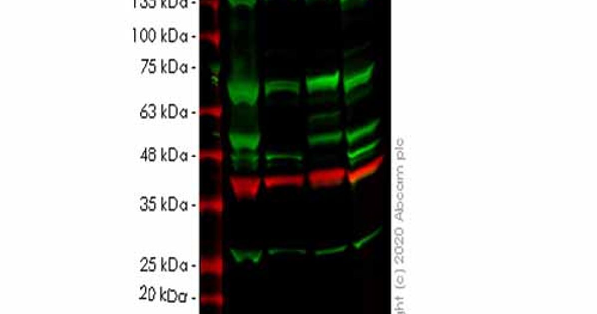 Human ILKAP knockout HEK293T cell line | SelectScience