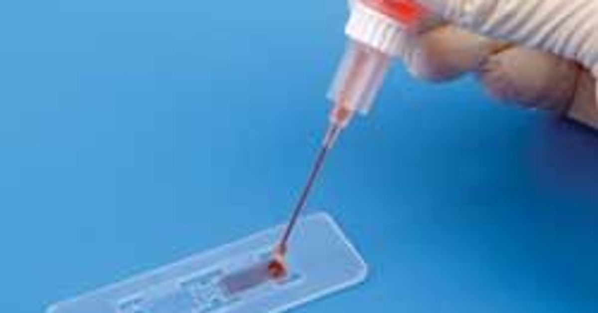 New Single Use Test for the Microscopic Counting of Leukocytes and ...