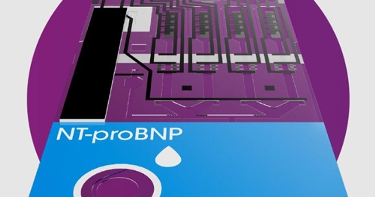 Buy NT-proBNP Test Read Reviews