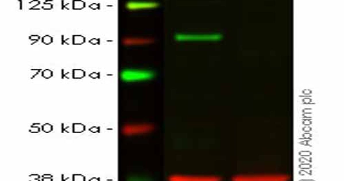 Human Stat5b Knockout Hela Cell Line Selectscience