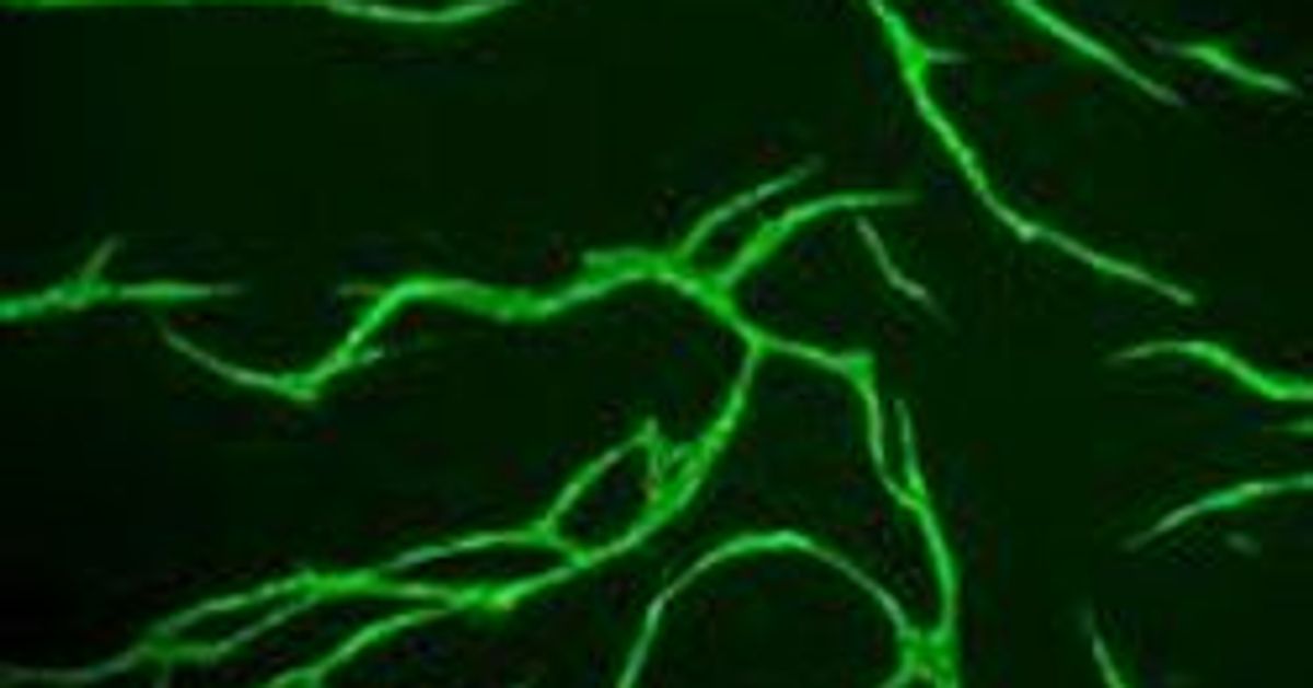 Cellomics Launches new HCS solutions for Oncology