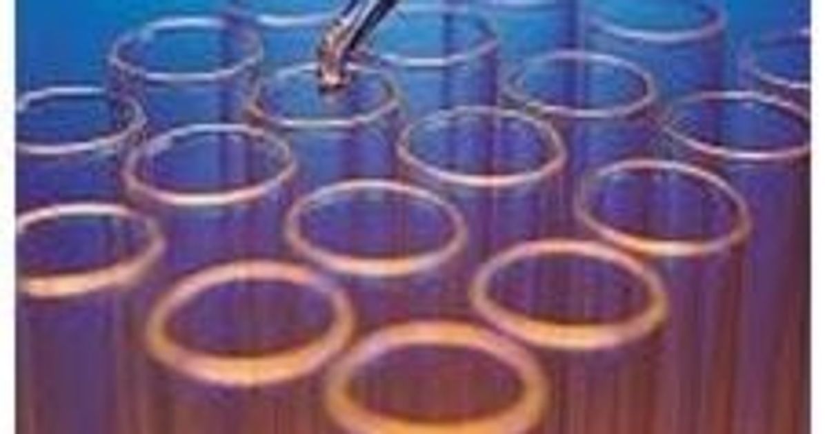 Agilent Drug Discovery Services: HTS