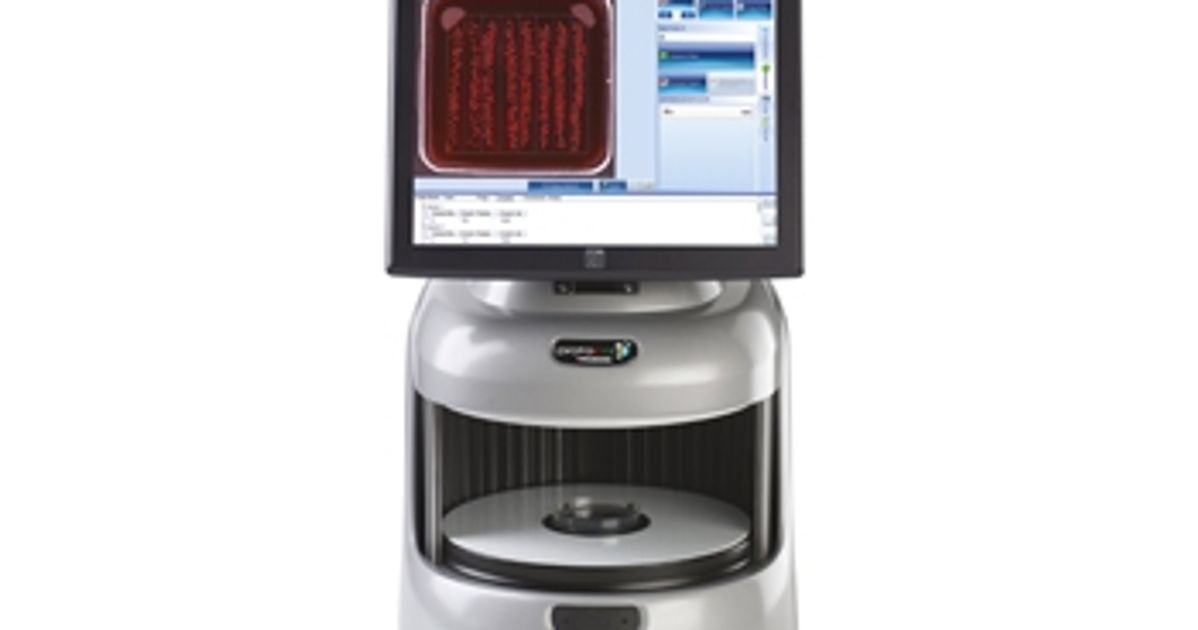 Automated colony counting saves time and boosts accuracy