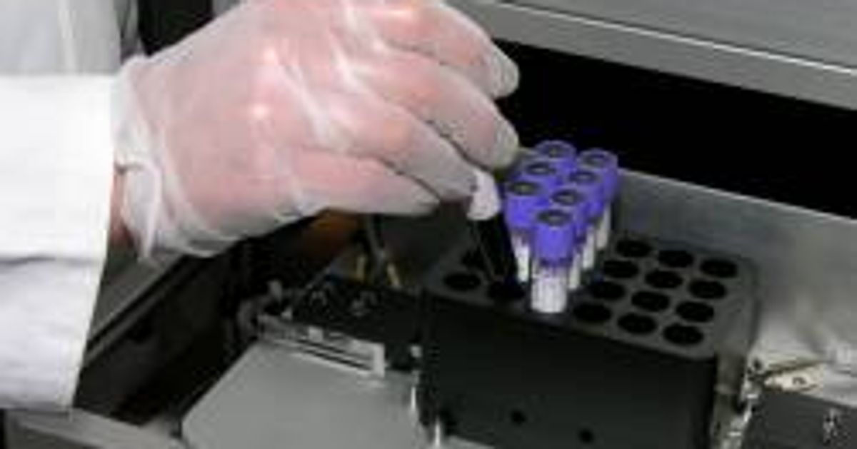 RTS Secures Major Contract for Phase One of an Automated Blood ...