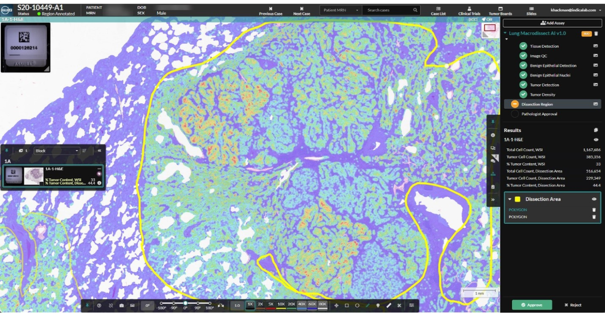 Indica Labs announces launch of AI-powered macrodissection suite to ...