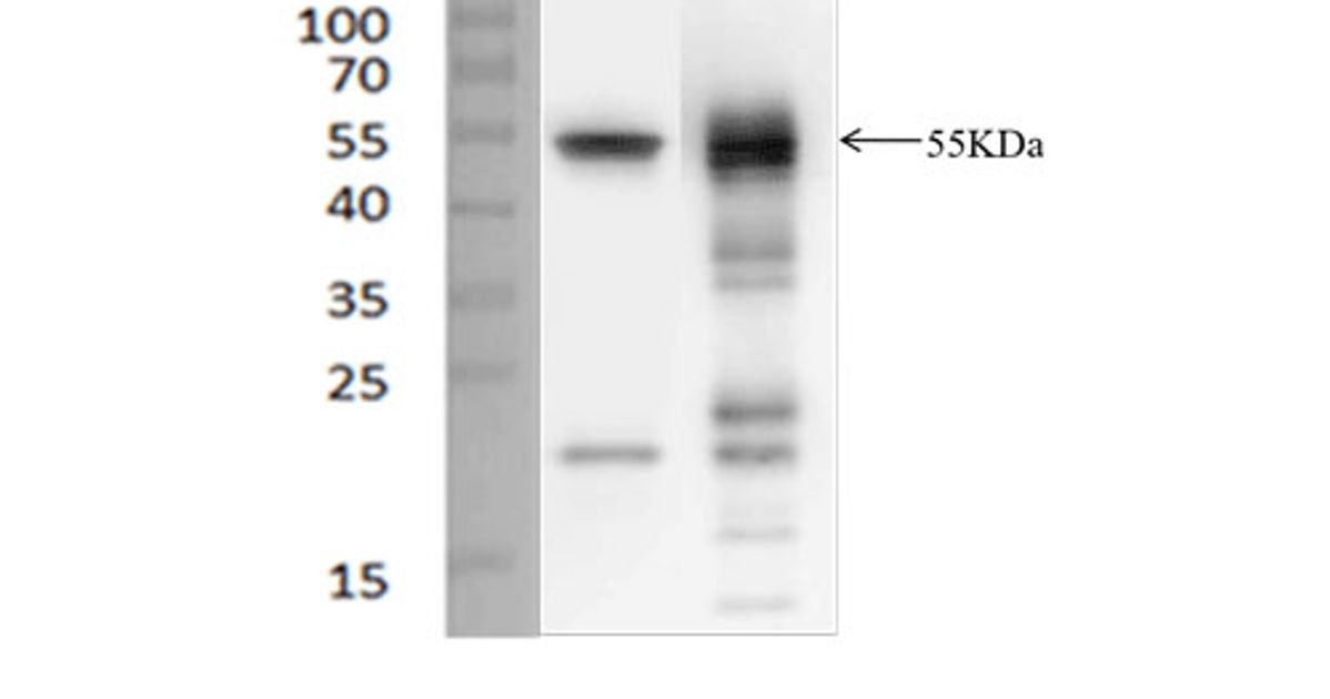 Mouse anti-SARS-COV-2 N-Protein (1G1-F2) | SelectScience