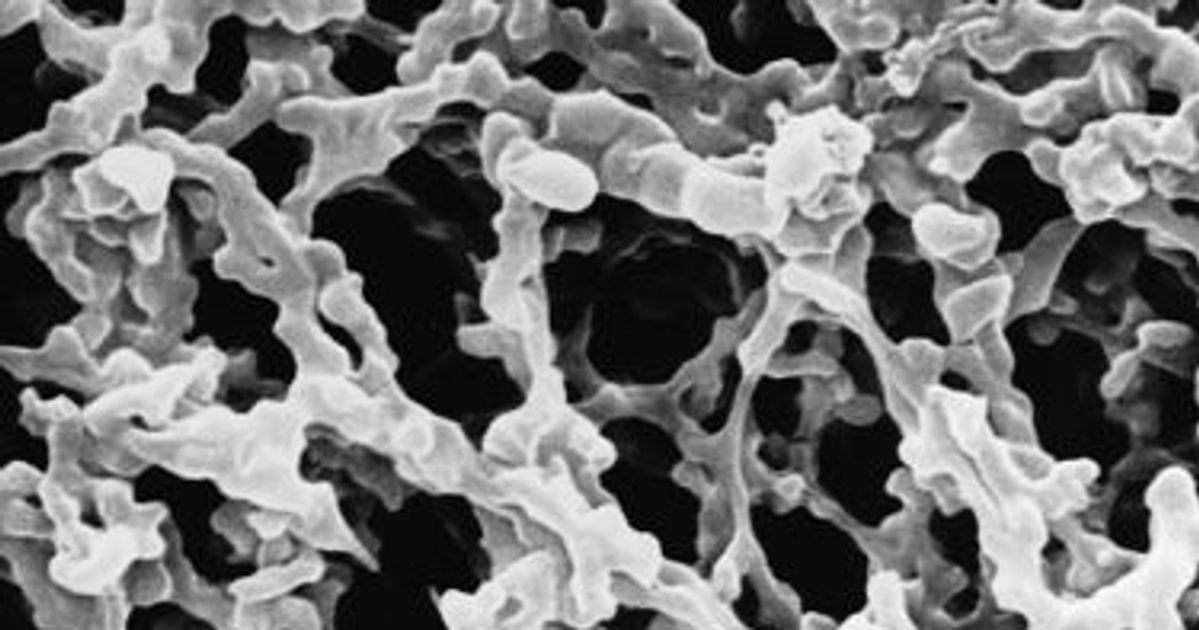 MF-Millipore™ Membrane Filter | SelectScience