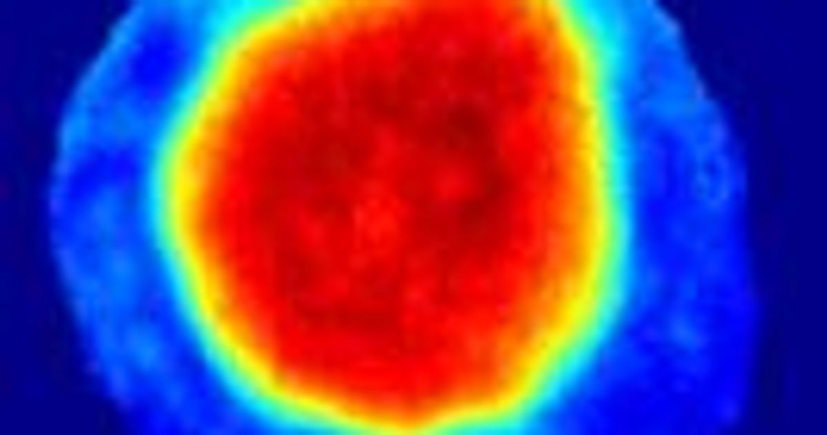 An Introduction to Chemical Imaging with Malvern Instruments