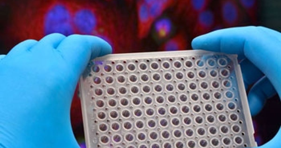 EUROIMMUN to provide CE-marked antibody detection systems to support ...