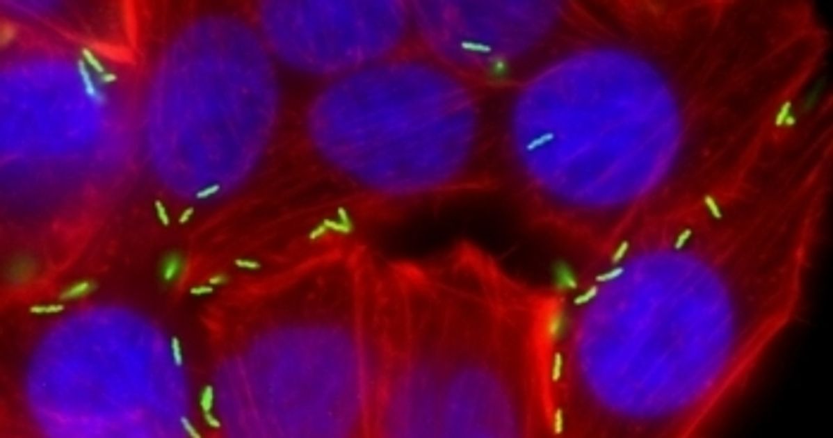 Researchers discover protein that could be the key to blocking ...