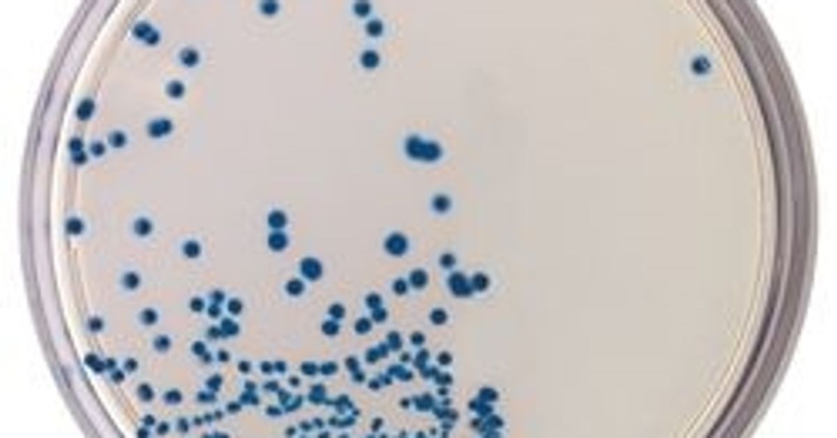 BD BBL™ CHROMagar™ CPE Plate reviews