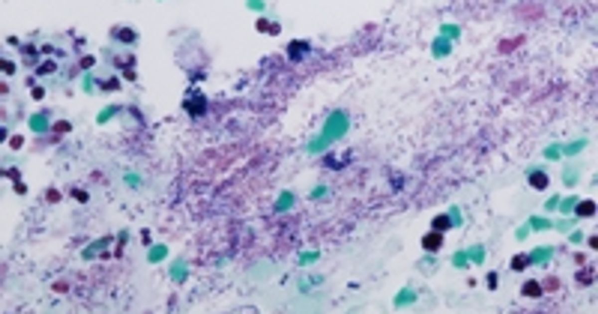 Ventana Launches Fully Automated Gram Stain on the BenchMark Special ...