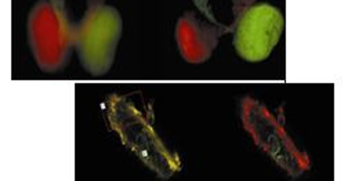 Nikon Launches New Macro Laser Confocal Microscope to Enable Live Cell ...