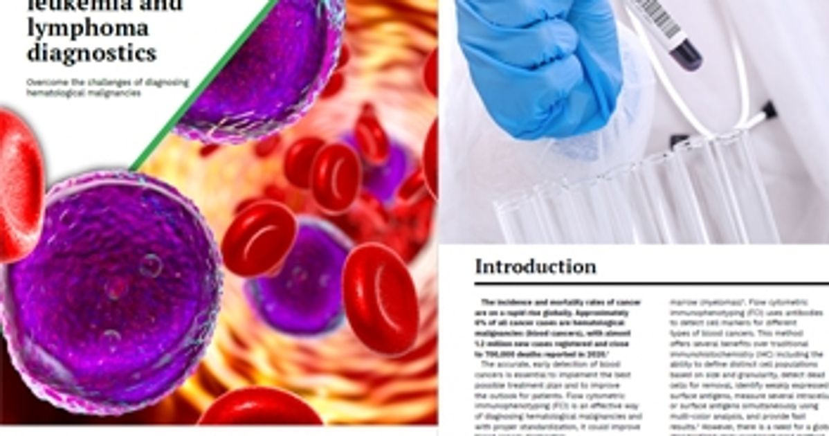 Steps to standardize and streamline leukemia and lymphoma diagnostics