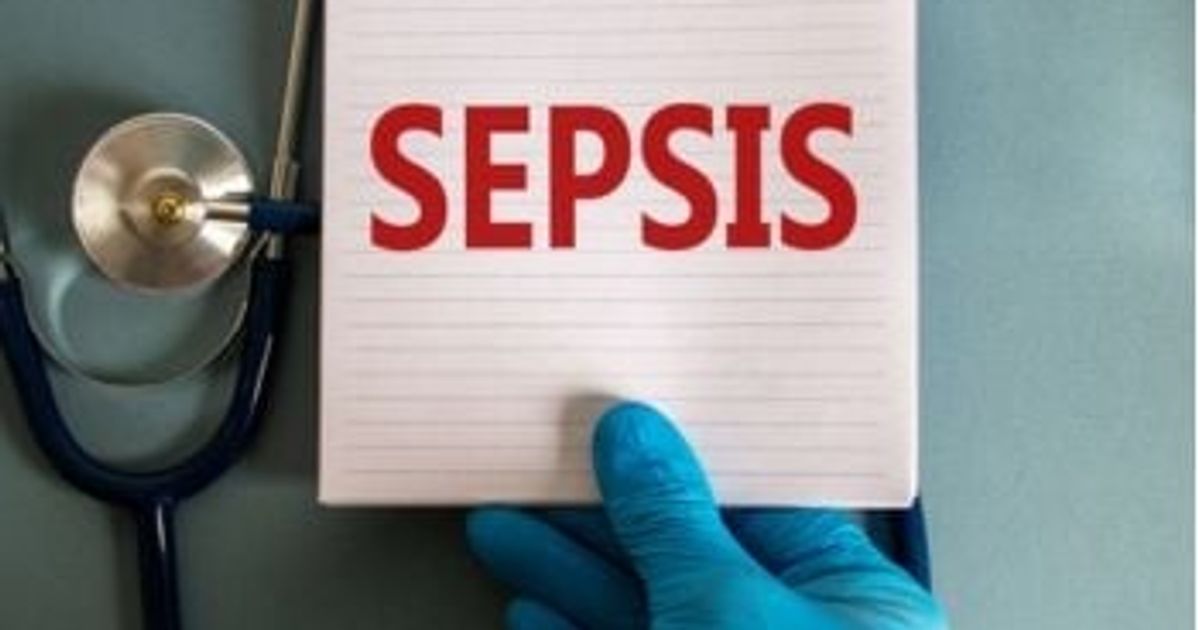 Extraordinary advances in sepsis diagnosis and monitoring ...