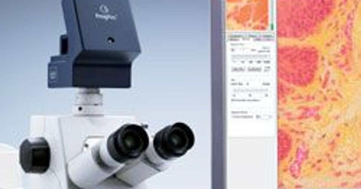 ProgRes® - making high quality imaging affordable