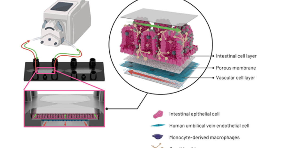 A possible game-changer: infectious disease modelling with organ-on ...