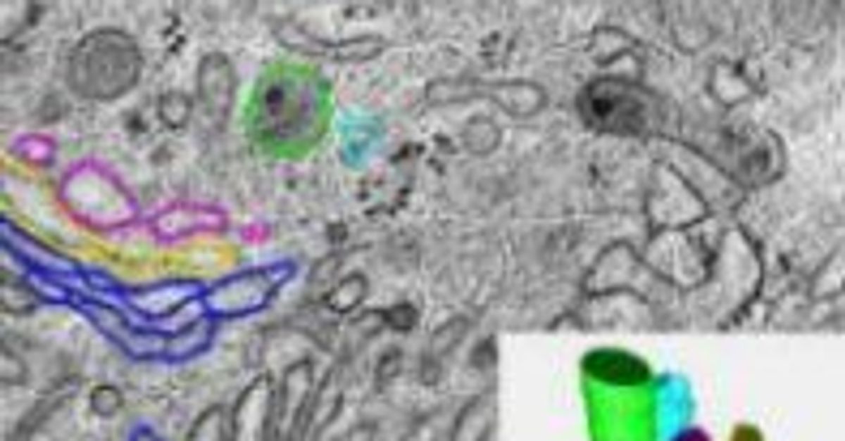 Agar announces the availability of the Fischione Instruments Range of ...