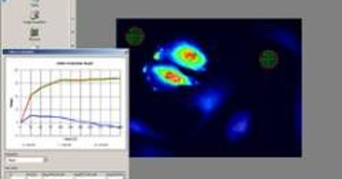 Release 4.6 of the AxioVision FRET microscopy software from Carl Zeiss allows the comprehensive ...