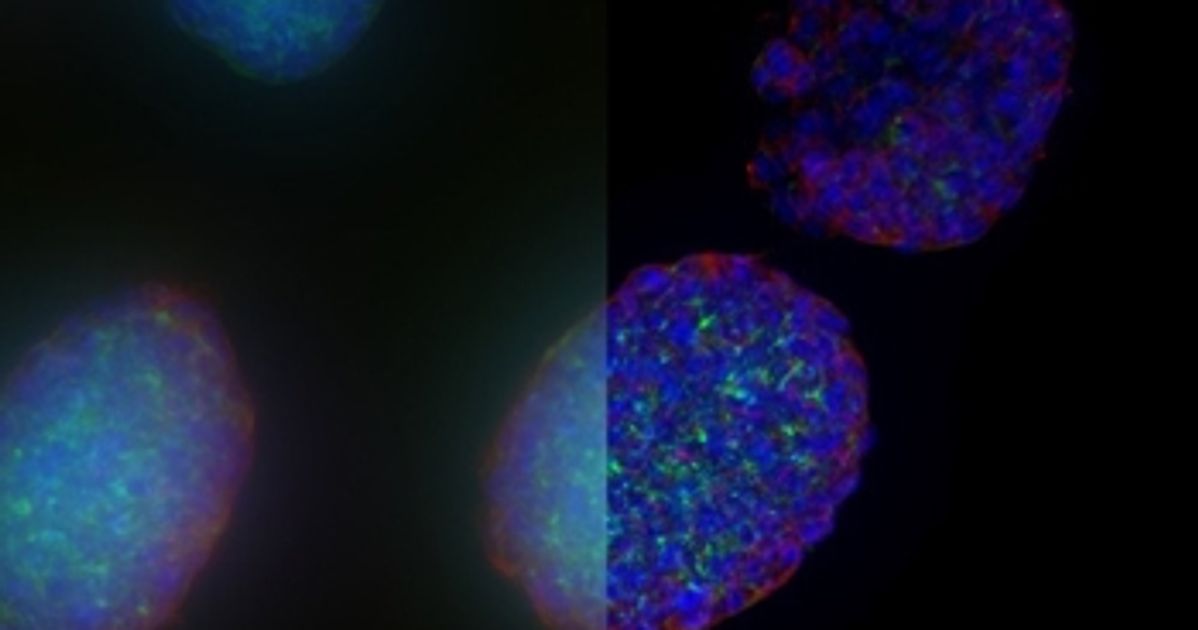 Seeing in 3D: How cell culture imaging just got easier