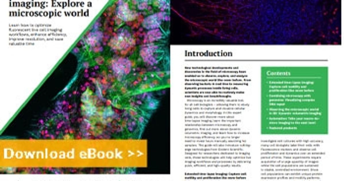 The biologist’s guide to fluorescent live cell imaging: Explore a ...