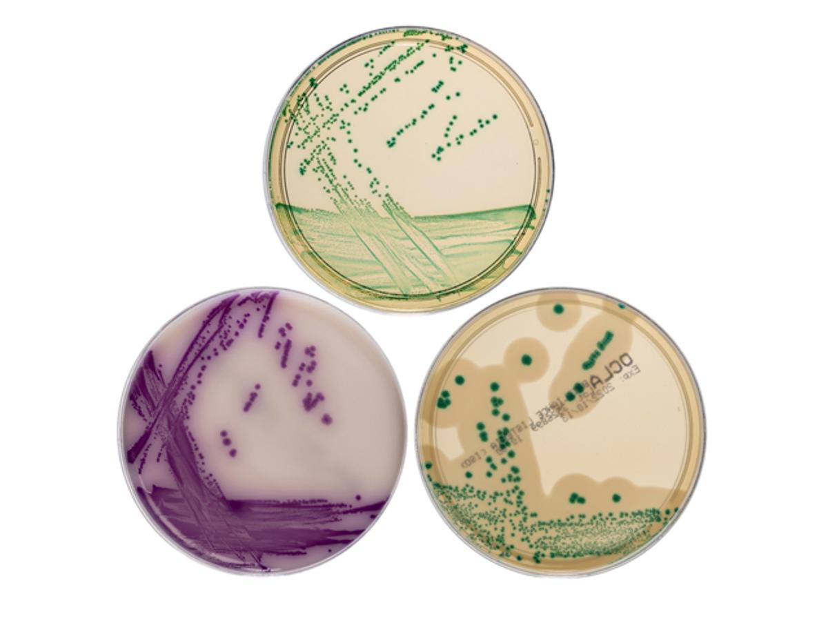 Precision Plus Protein™ Unstained Protein Standards, Strep-tagged ...