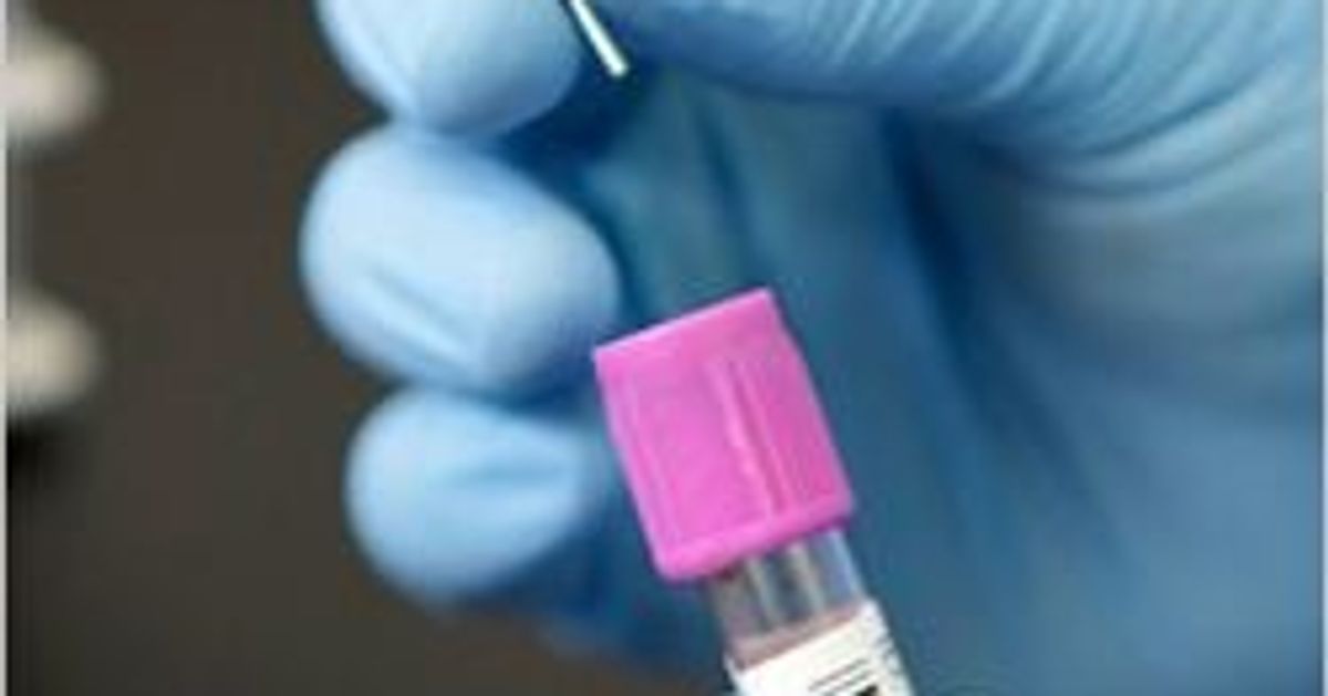 SmearSafe Blood Dispenser