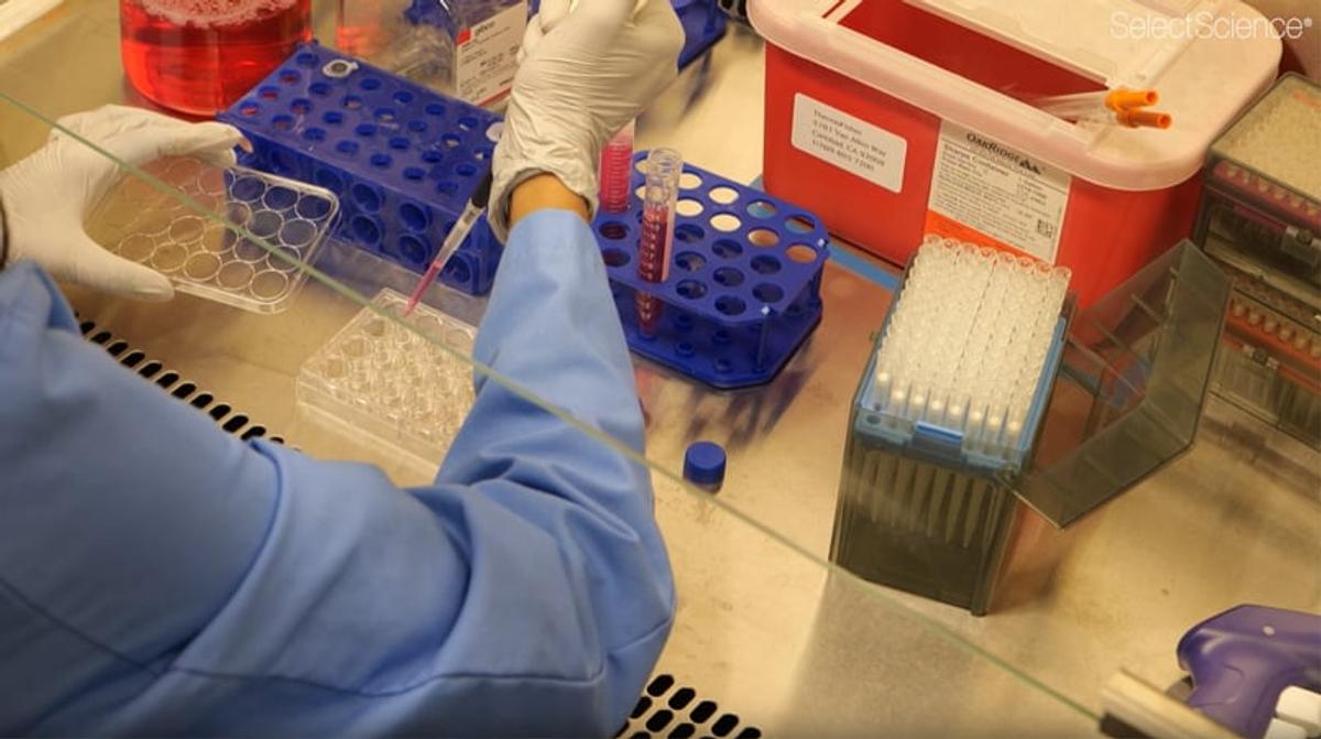 Invitrogen™ Neon™ Transfection System reviews